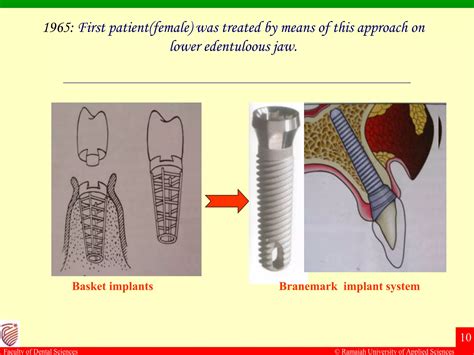Biological Aspect Of Implant Ppt