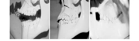 Double Wire Cross Brace Download Scientific Diagram