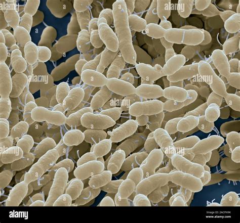 Pasteurella Multocida