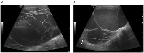 First Signs Of Liver Disease In Cats
