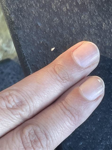 These Tiny White Bugs Are All Over My Yard This Year My Husband Wants