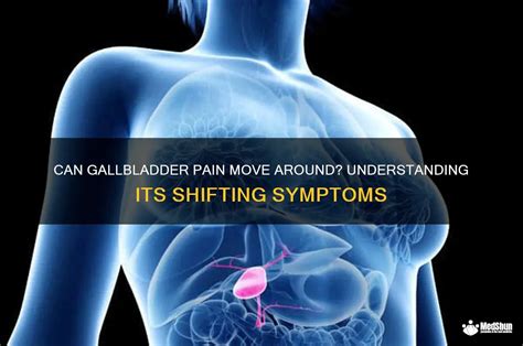 Can Gallbladder Pain Move Around Understanding Its Shifting Symptoms