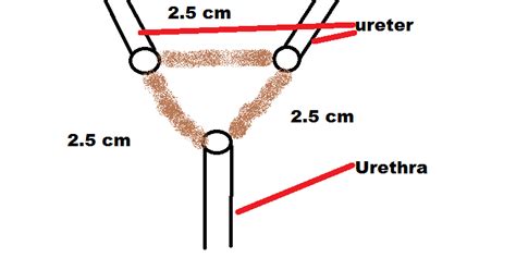 Easyhumanatomy Trigone Of Urinary Bladder