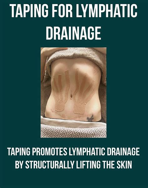 Kinesio Taping For Lymphatic Drainage