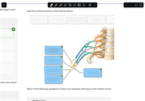 Brachial Plexus Connect Quiz Diagram Quizlet