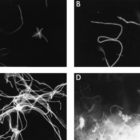 A Thin Cross Section Of Thiothrix Sp Strain Ta Labeled With Mab