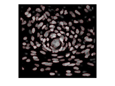 Basic Cell Counting And Segmentation In Matlab