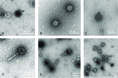 Transmission Electron Microscopy Of Six Agrobacterium Phages A To C Download Scientific