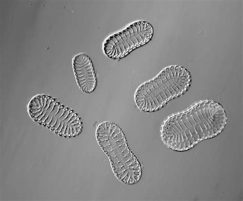 Diatom Blood Under A Microscope