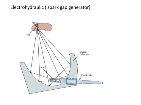 Ppt Lithotripter Energy Source Powerpoint Presentation Free Download