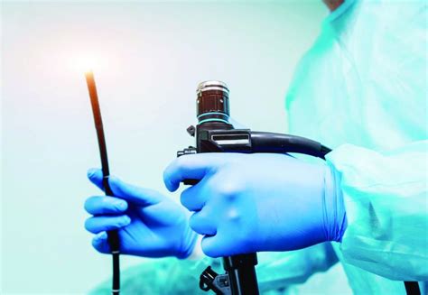 Colonoscopy Dsa Gastroenterology