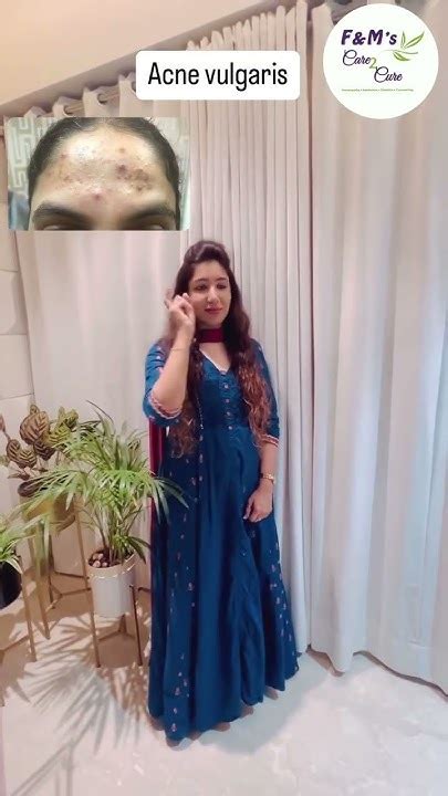 Dr Humera Khan — Acne Vulgaris Youtube