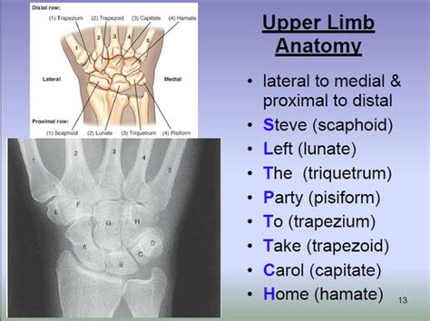 Rad 141 Wrist And Forearm Flashcards Quizlet