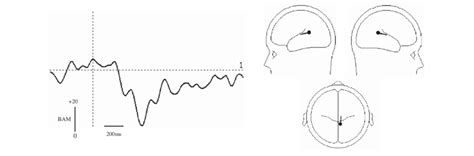 Results Of The Dipole Source Analysis Of Different Wave In The Time