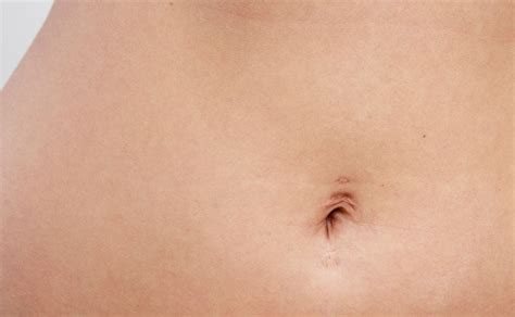 Belly Button Piercing Scar After Removal 7 Ways To Get Rid Of Belly