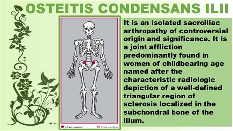 Osteitis Condensan Illi Radiology Classroom