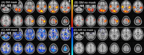 How Do Surgical Face Masks Affect Functional Mri Measurements