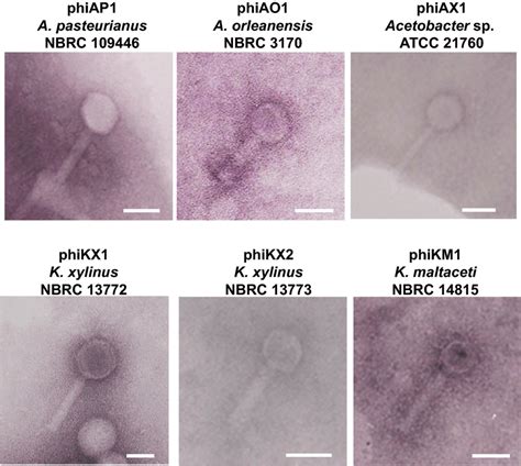 Tem Photographs Of Temperate Phages Produced By Acetic Acid Bacteria