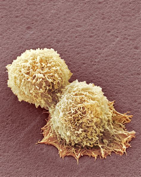 Sarcoma Cells Sem Stock Image M1321001 Science Photo Library