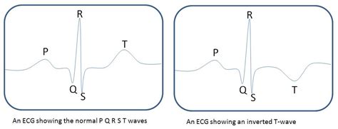 Cardiovascular System Heart Rate Development Embryology