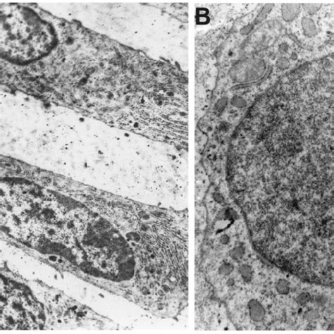Factor Analysis Of Chondroblast Gene Expression In Is Vertebra And