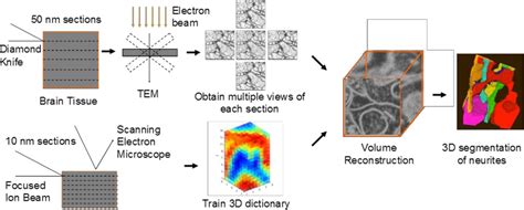 Figure 1 From Electron Microscopy Reconstruction Of Brain Structure Using Sparse Representations