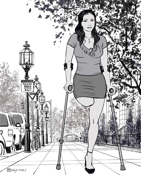 Amputee Legs Stumps And Prostheses