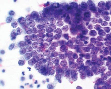 Sheet Of Mesothelial Cells Note That Although Variation In Nuclear