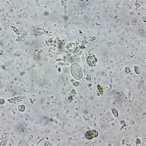 Stool Stoolexaminaton Giardia Cystgiardia Laboratory