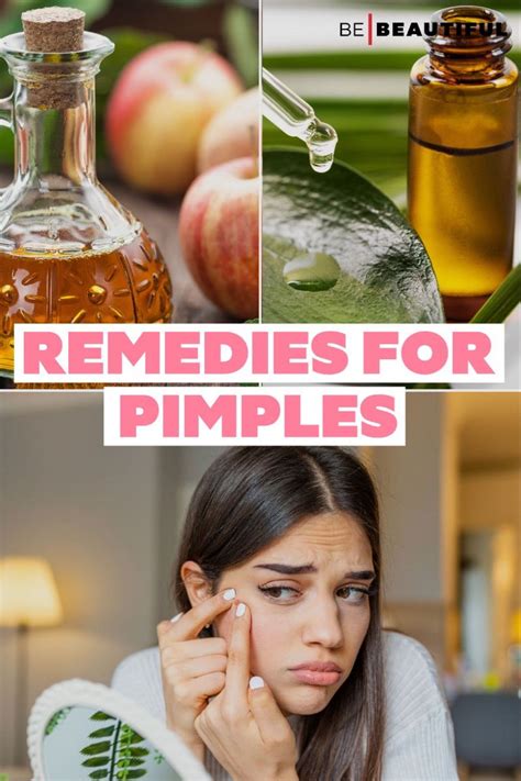 How To Get Rid Of Pimples Overnight 10 Home Remedies For Pimples Artofit