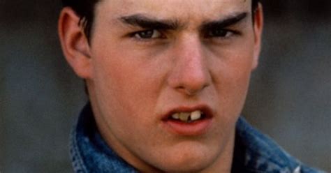 Tom Cruise Back In The Outsiders Days Teeth Tooth Teeths