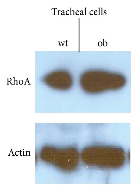 Rhoa Expression Is Increased In Obese Mice Rhoa Expression In Mouse Download Scientific