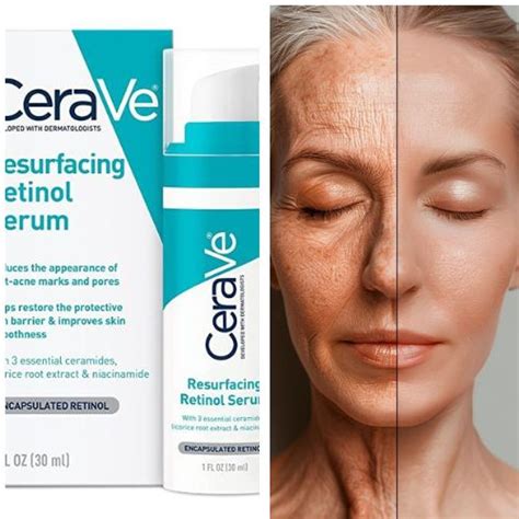 Retinol For Skin Benefits Routine And Skincare Tips