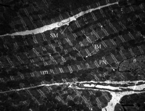Image Of Adult Mouse Cardiomyocyte Obtained By Electron Microscopy