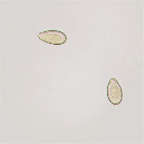 Clonorchis Sinensis Egg Wm Microscope Slide Carolina Biological Supply