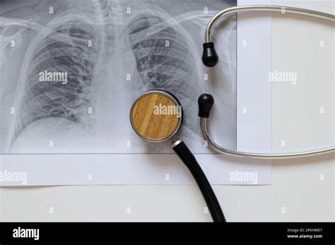 Fluorographic Image Of The Lungs On Paper And A Stethoscope Healthy