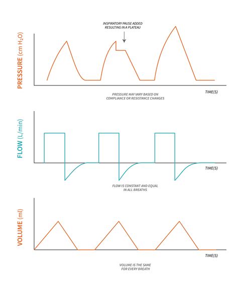 Control De Volumen En Ventilación Mecánica Descifrando Las Ondas De