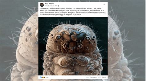 Human Skin Mites Tyrophagus Putrescentiae Wikipedia