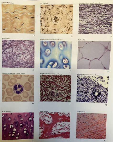 Epithelial And Connective Tissue 2 Diagram Quizlet