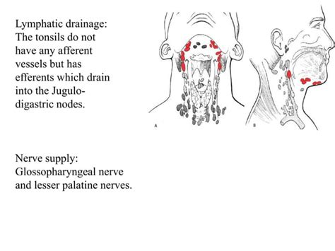 Tonsillitis Pptx Ear Nose And Throat Conditions Diseases And