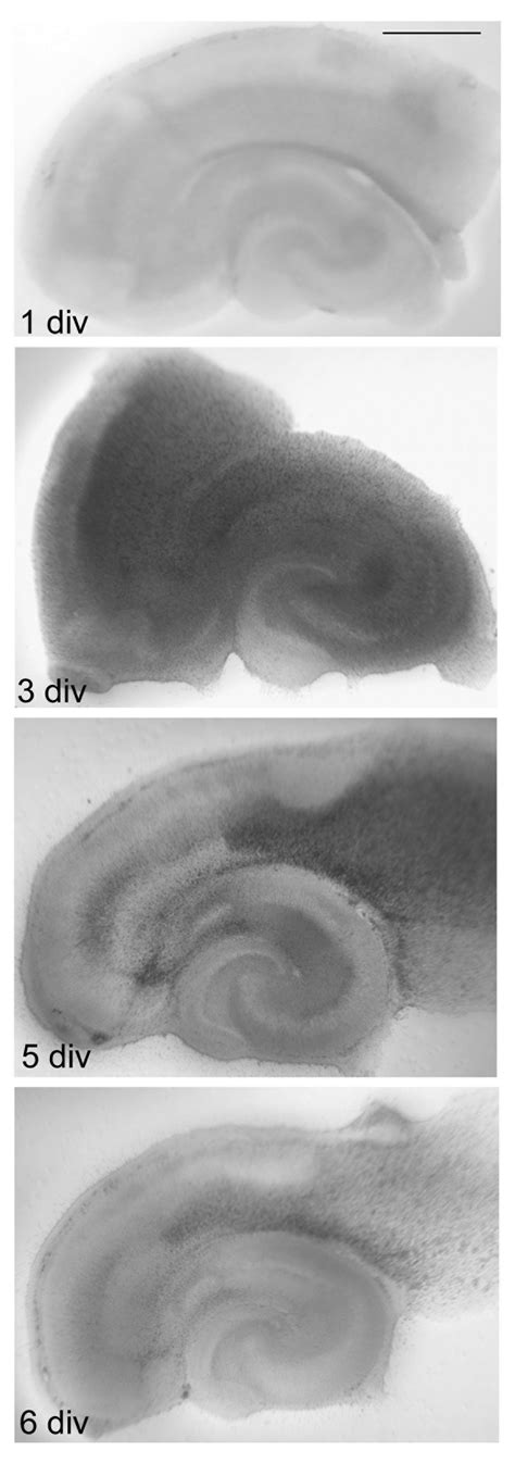Organotypic Hippocampal Slice Cultures As A Model To Study