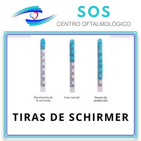 Test De Shirmer Centro Oftalmológico Sos
