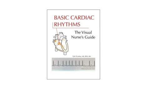 Ppt Download Pdf Basic Cardiac Rhythms The Visual Nurses Guide