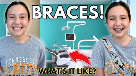 Braces Vlog What Getting Braces For The First Time Is Like Youtube