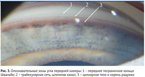 рис. 3. Опознавательные зоны угла передней камеры: 1 – переднее