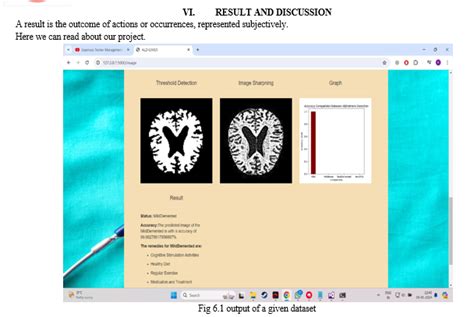 Alzhimer Detection Using Cnn