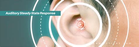 Auditory Steady State Response Assr Test Price In Pakistan