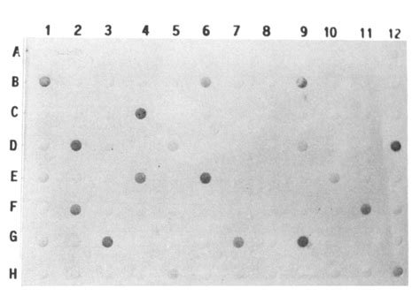 Application Of Dot Elisa In Screening And Diagnosis Of Bladder Cancer
