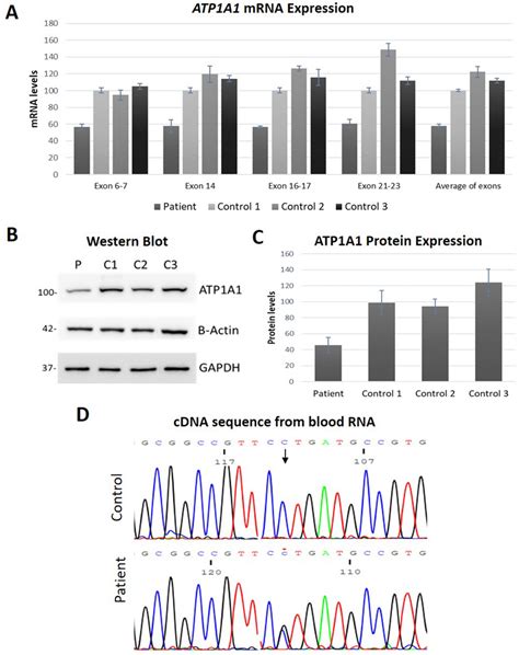 Mrna And Protein Expression Analysis Of The Wild Type And Mutant