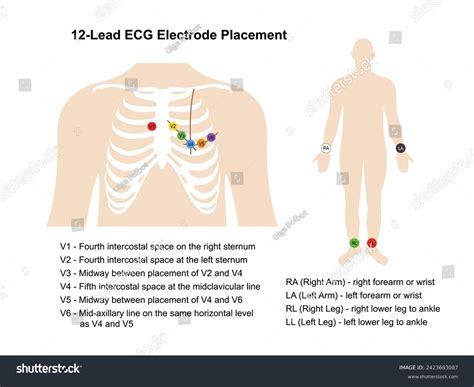 12 Lead Electrode Placement Diagram Ecg Electrode Position
